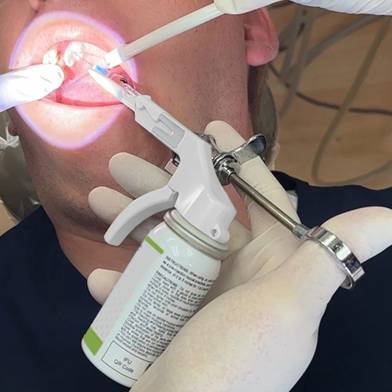 DentalJect Topical Anesthetic Spray | DentalJect